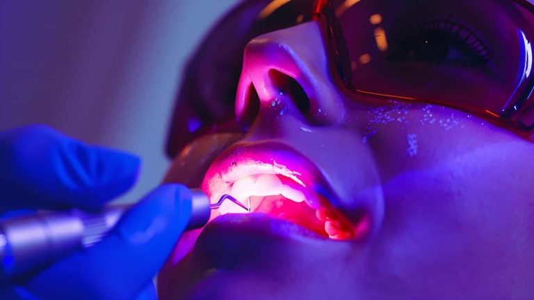 Why Biolase Dental Lasers Are Essential for Advanced Dental Care